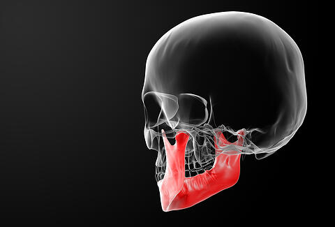 What Exactly Happens in Jaw Surgery in Singapore?