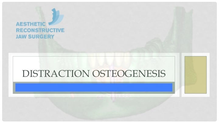 Distraction osteogenesis summary